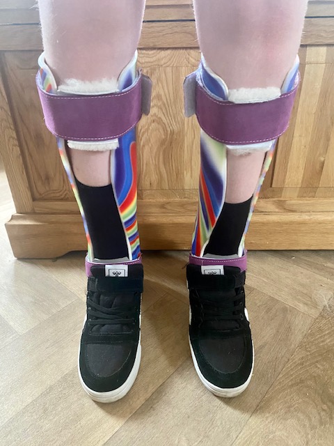 Cambridge cerebral palsy patient Grace's new AFOs help her walk without pain - London Orthotic ...