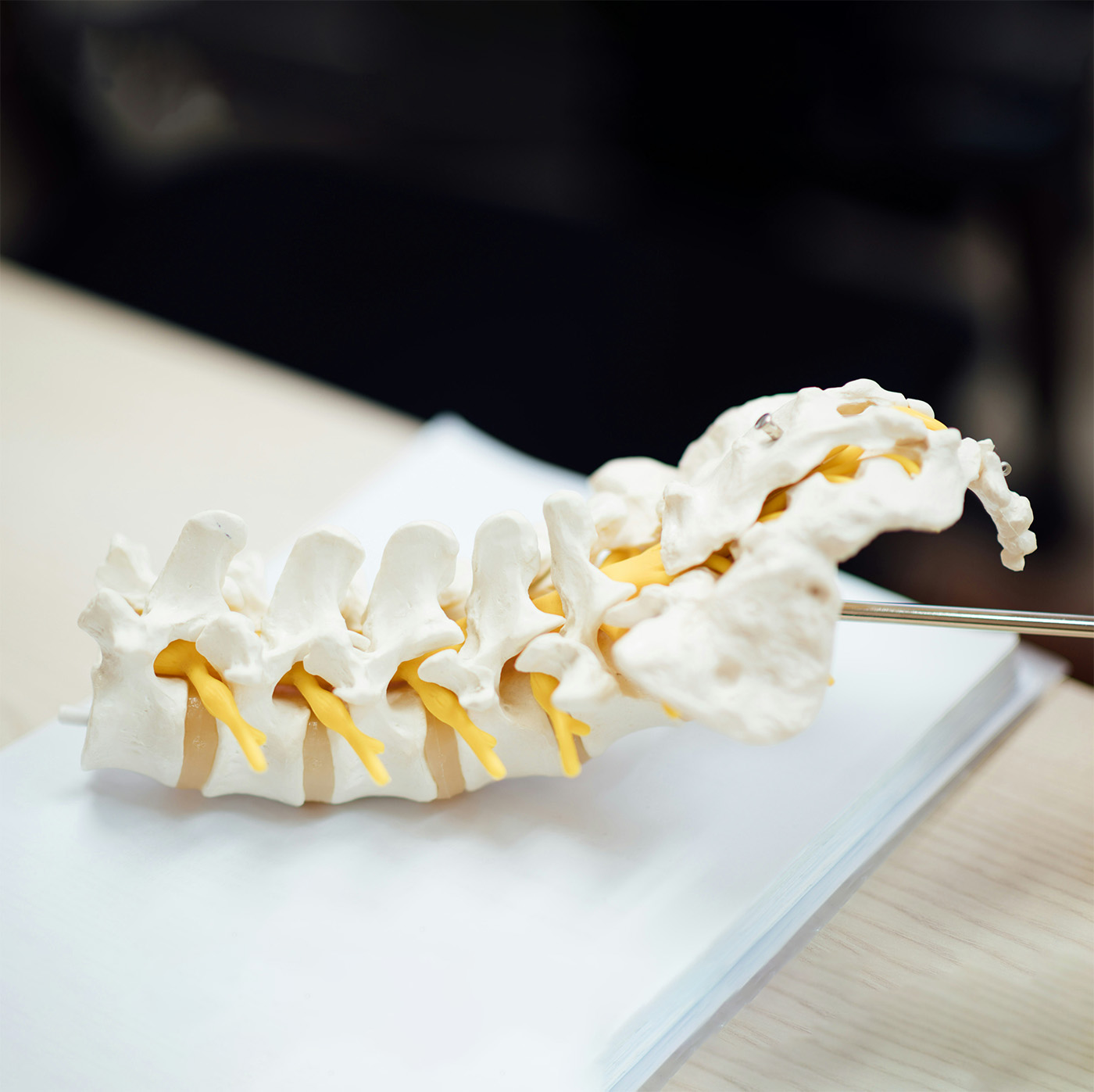 Pars defect (condition) | London Orthotic Consultancy