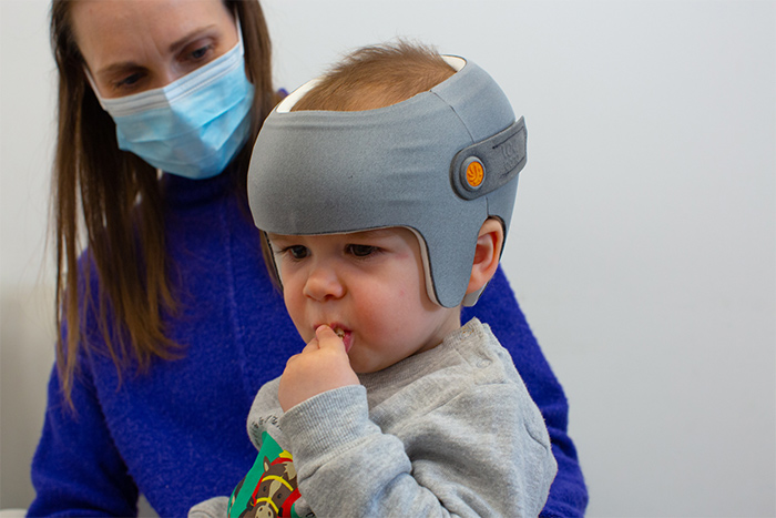 Max’s Plagiocephaly Story | Helmet Therapy at LOC Kingston